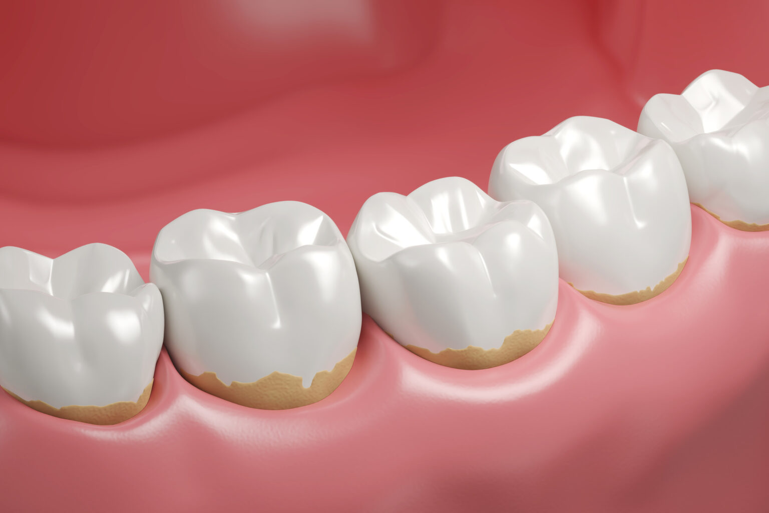 When Smiles Need A Deep Cleaning - Celina Family Dentistry